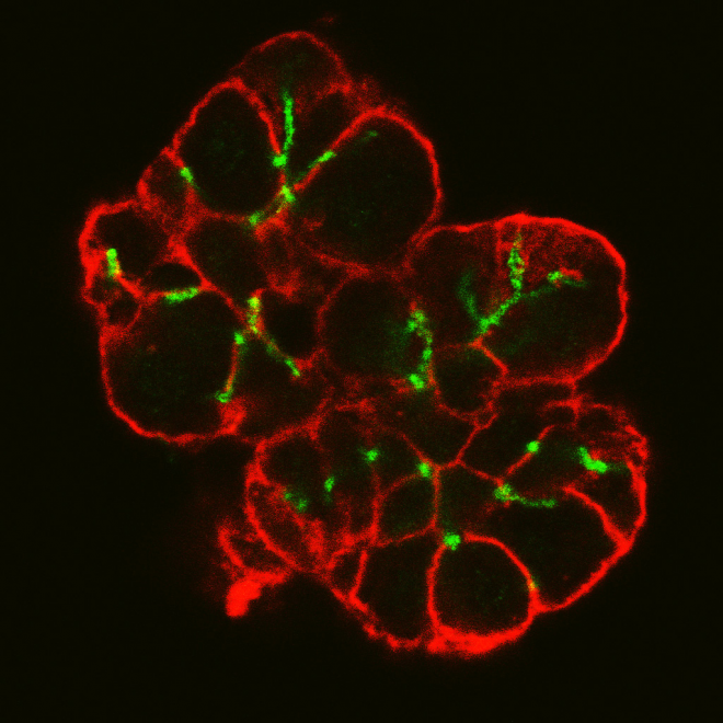 Multi-scale modelling of saliva secretion | New Zealand eScience ...